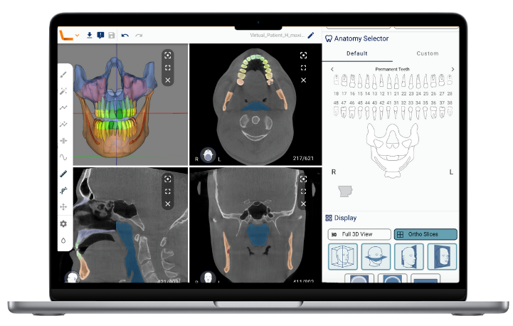 Relu® Creator | Automatic CBCT and IOS Segmentation | AI-Driven Dental software